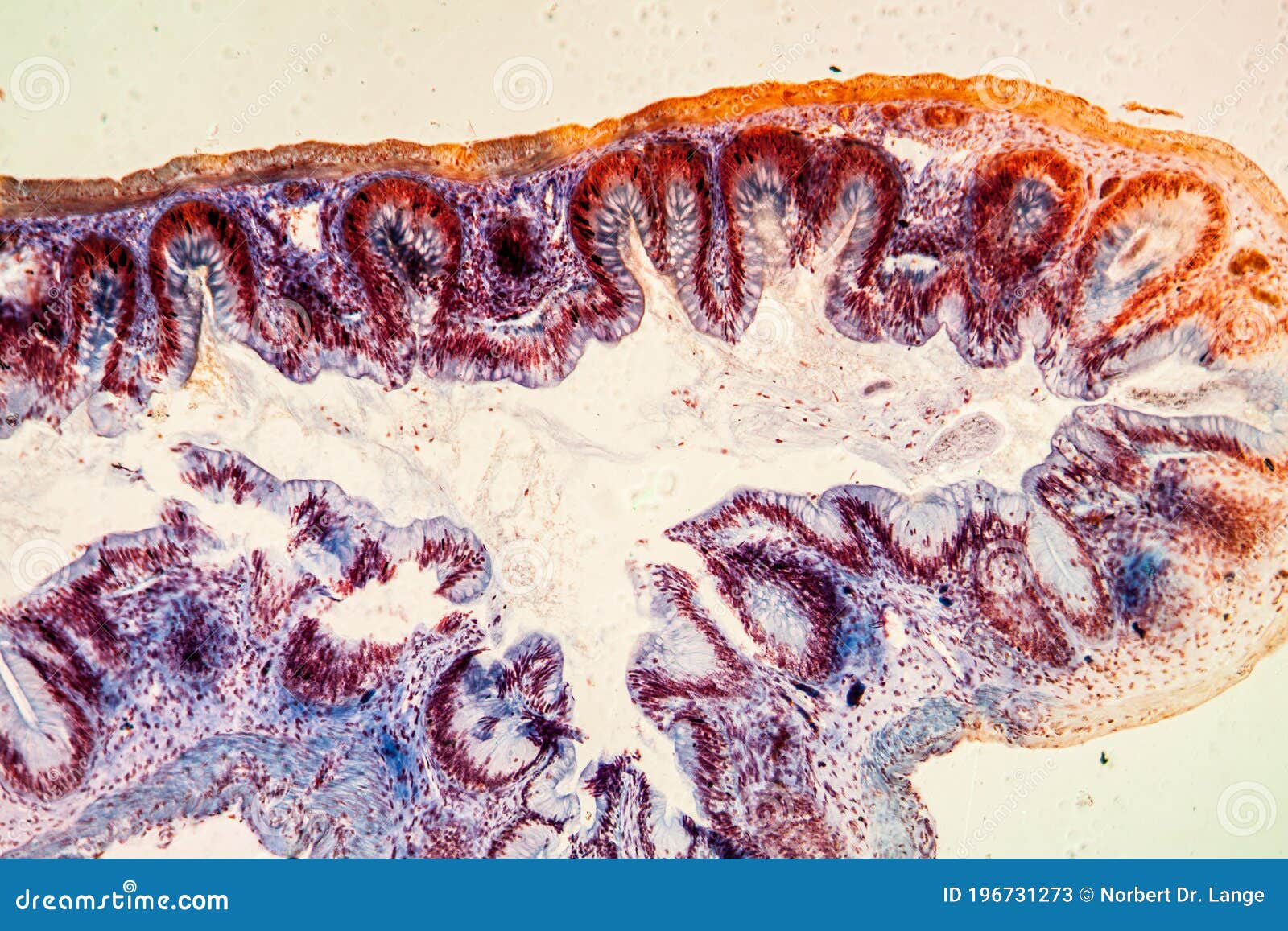 Colon with villi tissue stock image. Image of glass - 196731273
