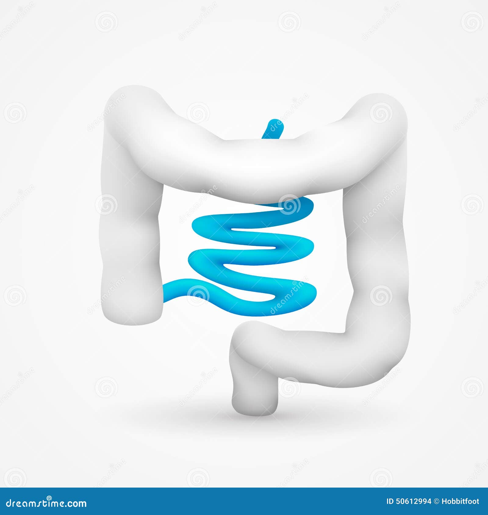 Diverticulitis Vector Illustration. Labeled Diagram With Its Structure ...