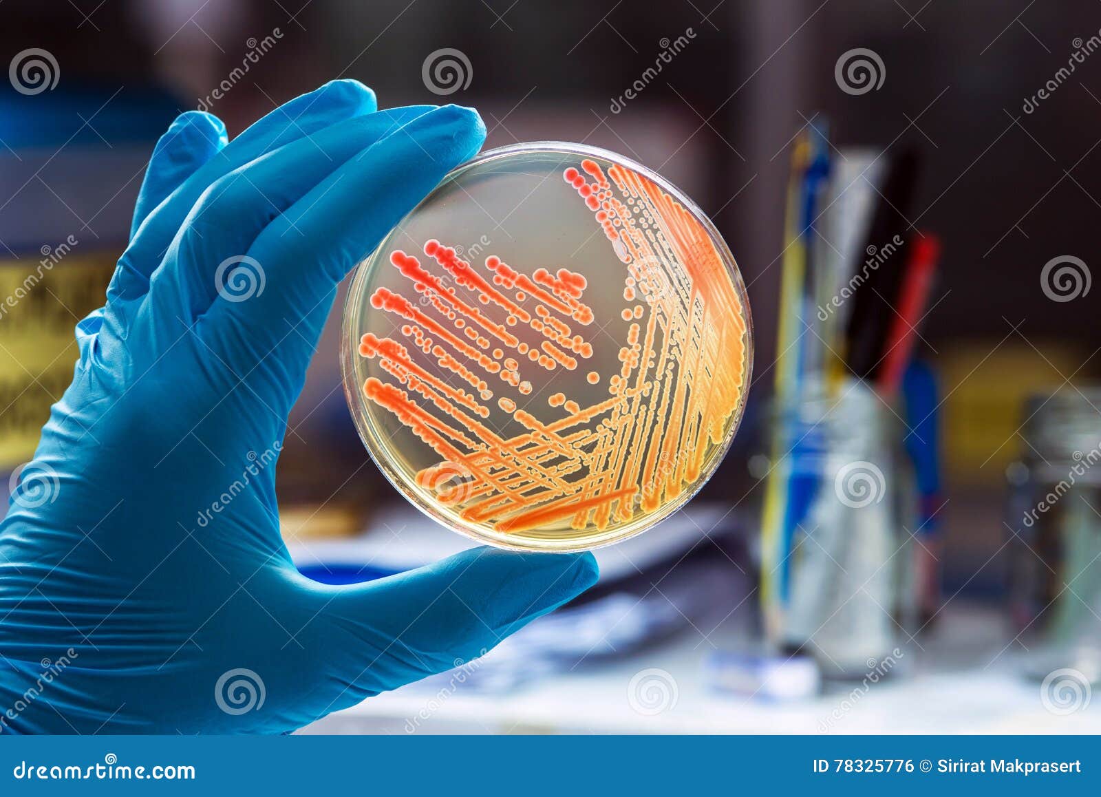 Colonies Bacteria Gram Negative Bacilli/ Gram Negative Cocco Bacilli ... Colonies Bacteria Gram Negative Bacilli/ Gram Negative Cocco Bacilli ...