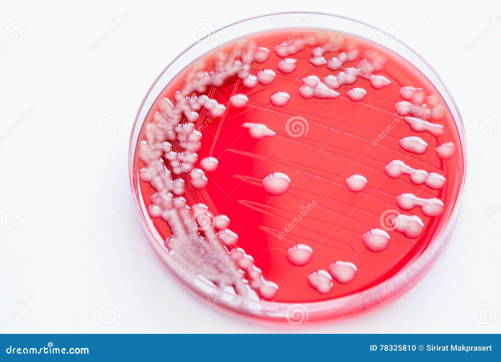 Colonies Bacteria Gram Negative Bacilli/ Gram Negative Cocco Bacilli on ...