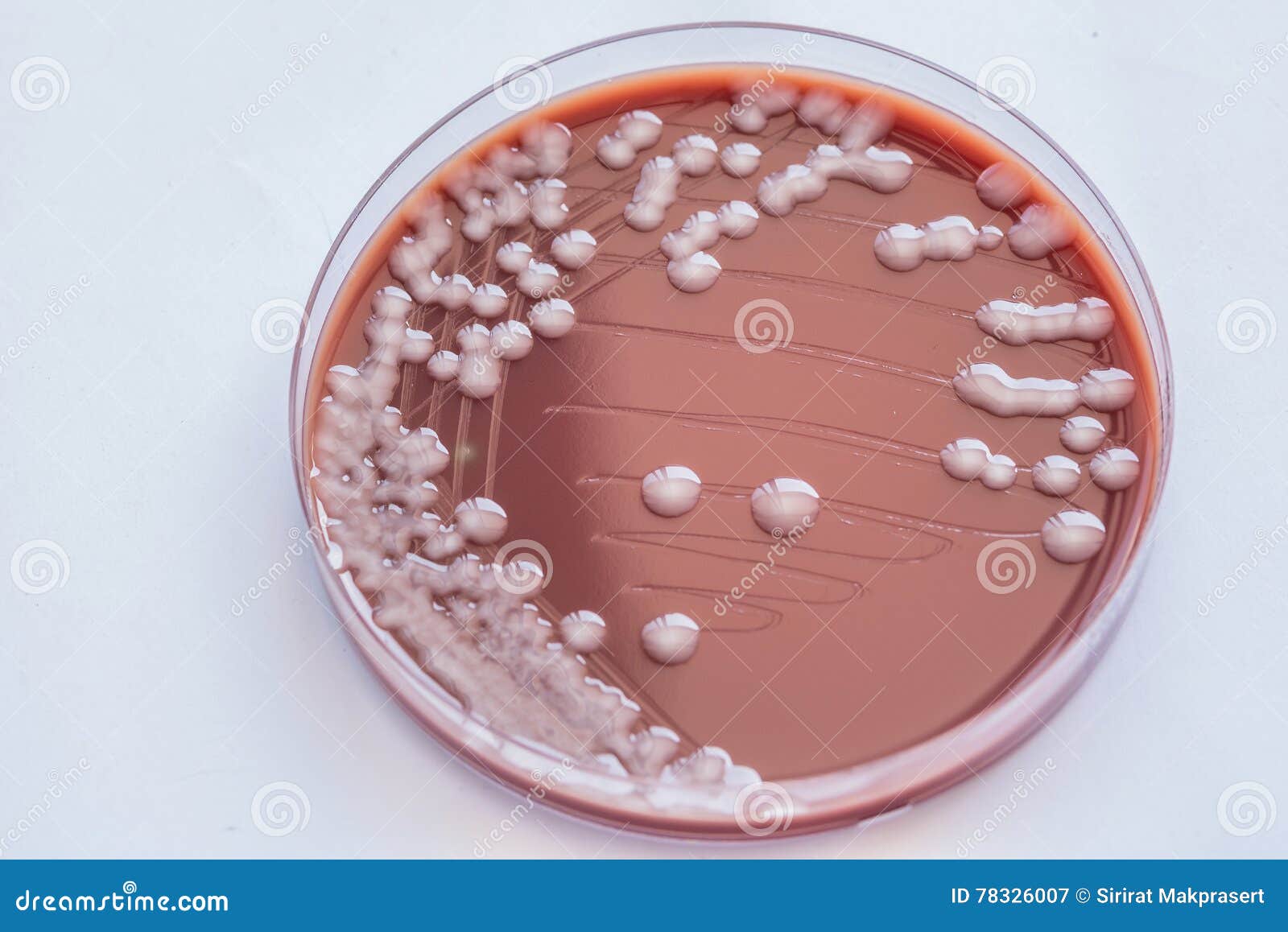 Colonies Bacteria Gram Negative Bacilli/ Gram Negative Cocco Bacilli on ...