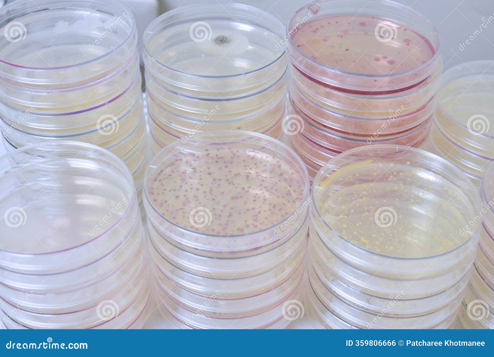 Bacteria Growth On A Plate Count Agar Plate Stock Photography ...
