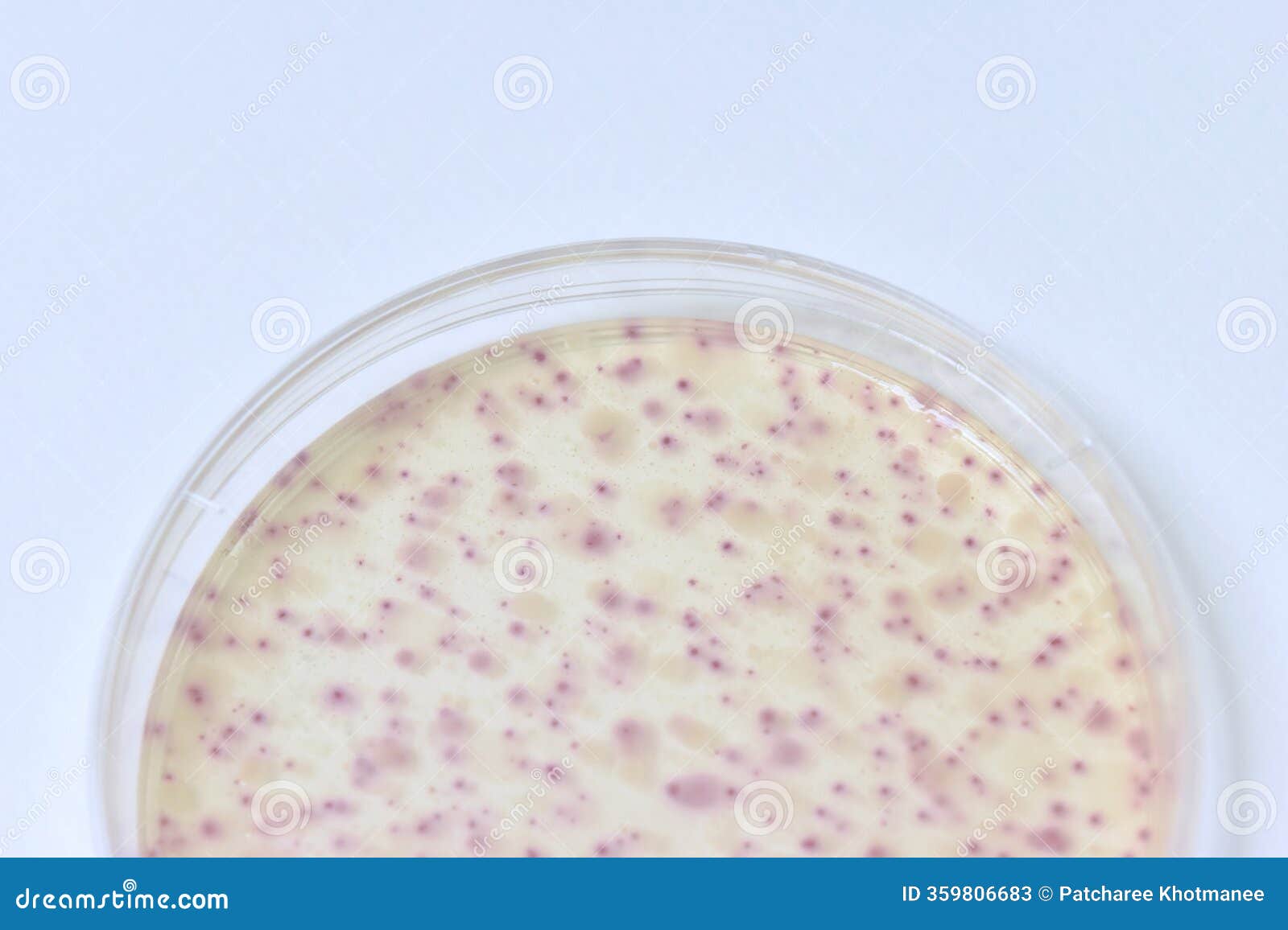 Colonies Of Bacteria Growth On Agar Plate Royalty-Free Stock Image ...