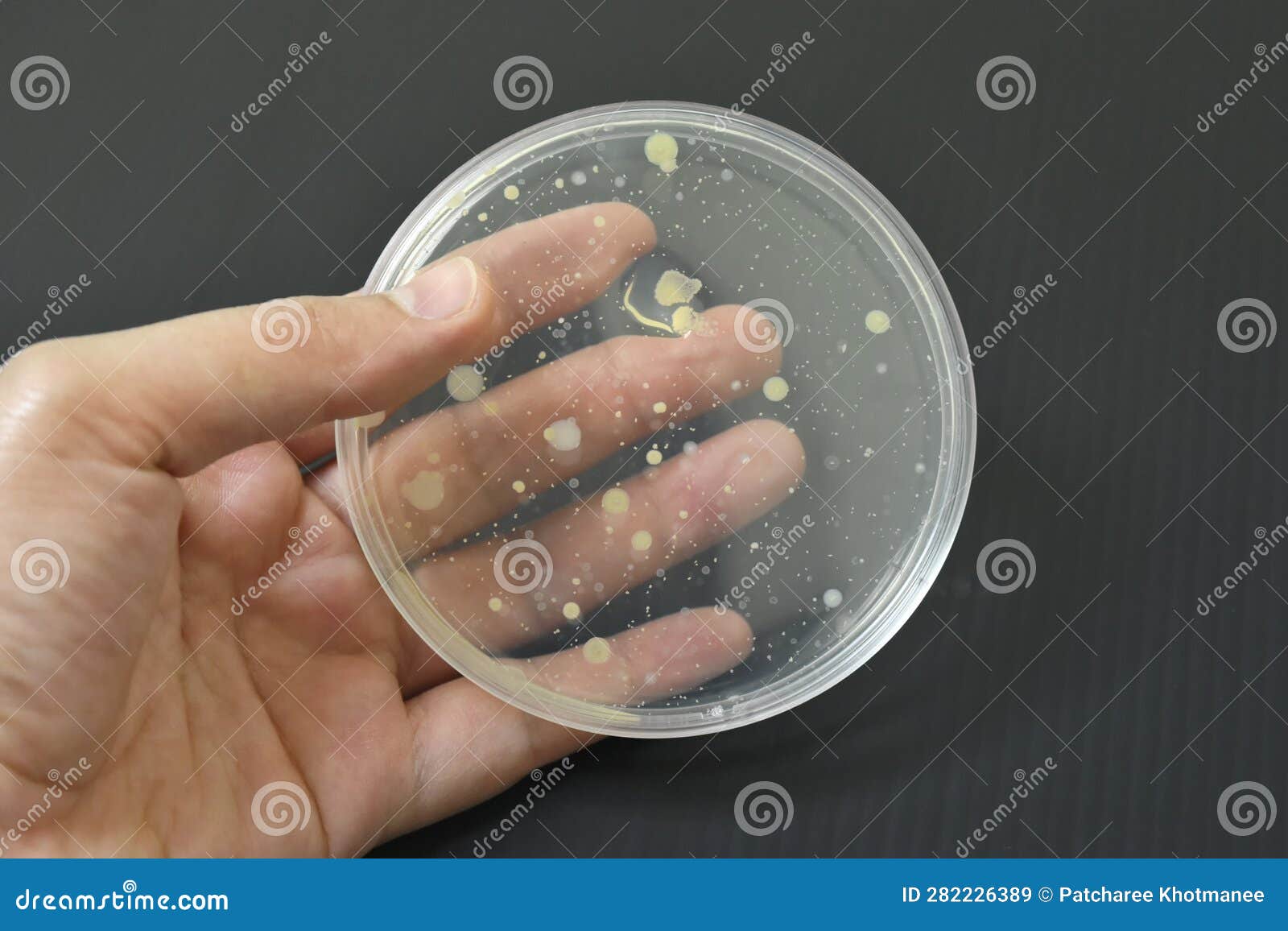 Colonies of Bacteria Growth on Agar Plate Medium in Laboratory Stock ...