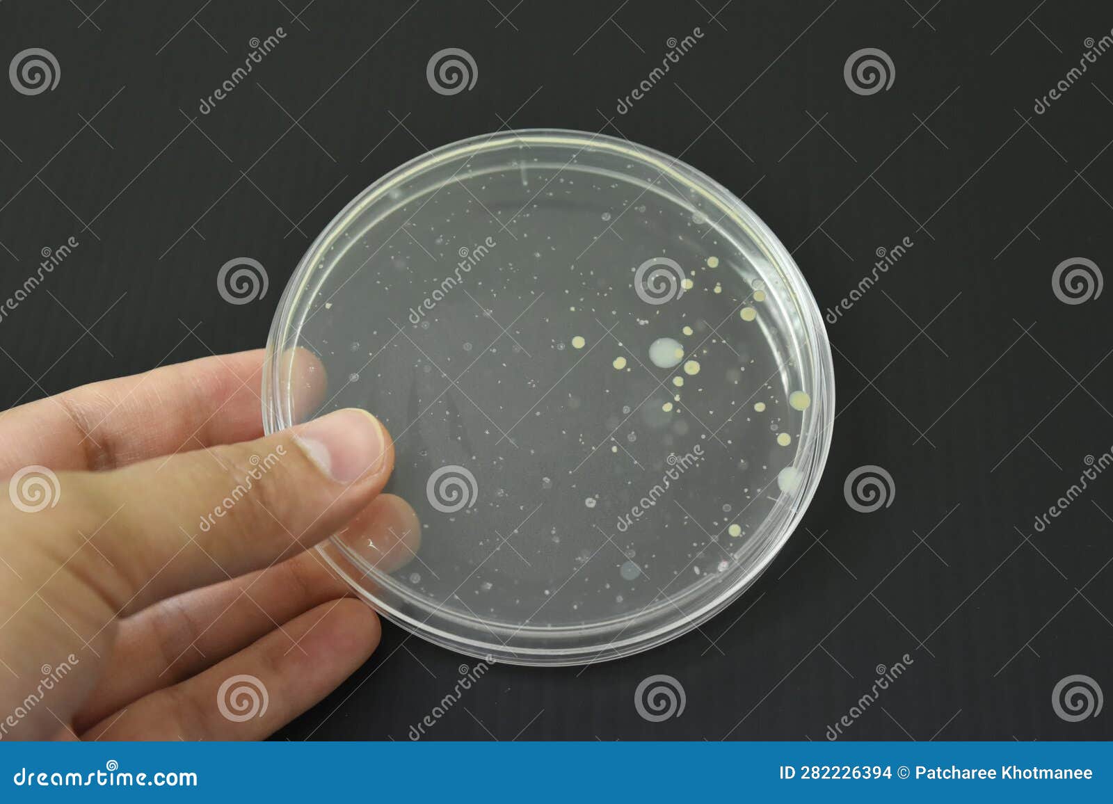 Colonies of Bacteria Growth on Agar Plate Medium in Laboratory Stock ...
