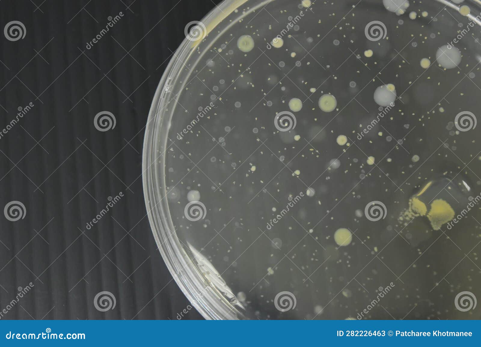 Colonies of Bacteria Growth on Agar Plate Medium in Laboratory Stock ...