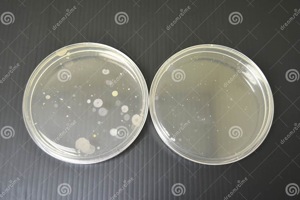 Colonies of Bacteria Growth on Agar Plate Medium in Laboratory Stock ...