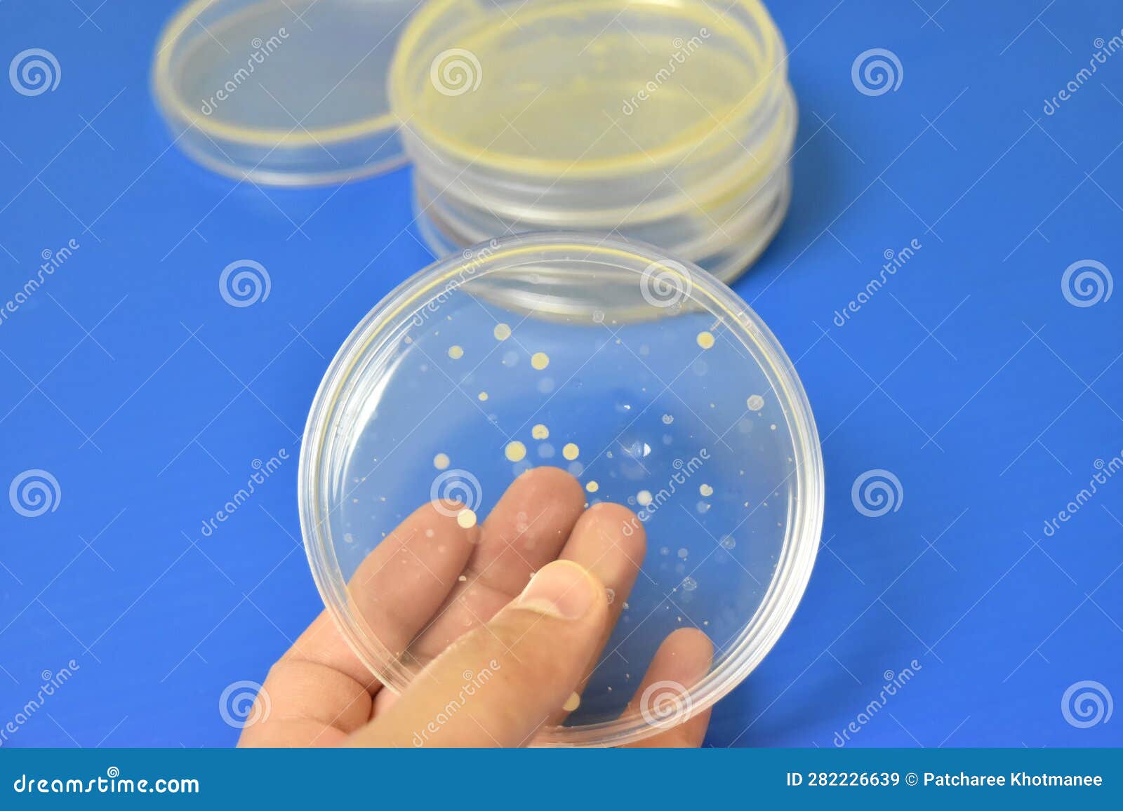 Colonies of Bacteria Growth on Agar Plate Medium in Laboratory Stock ...