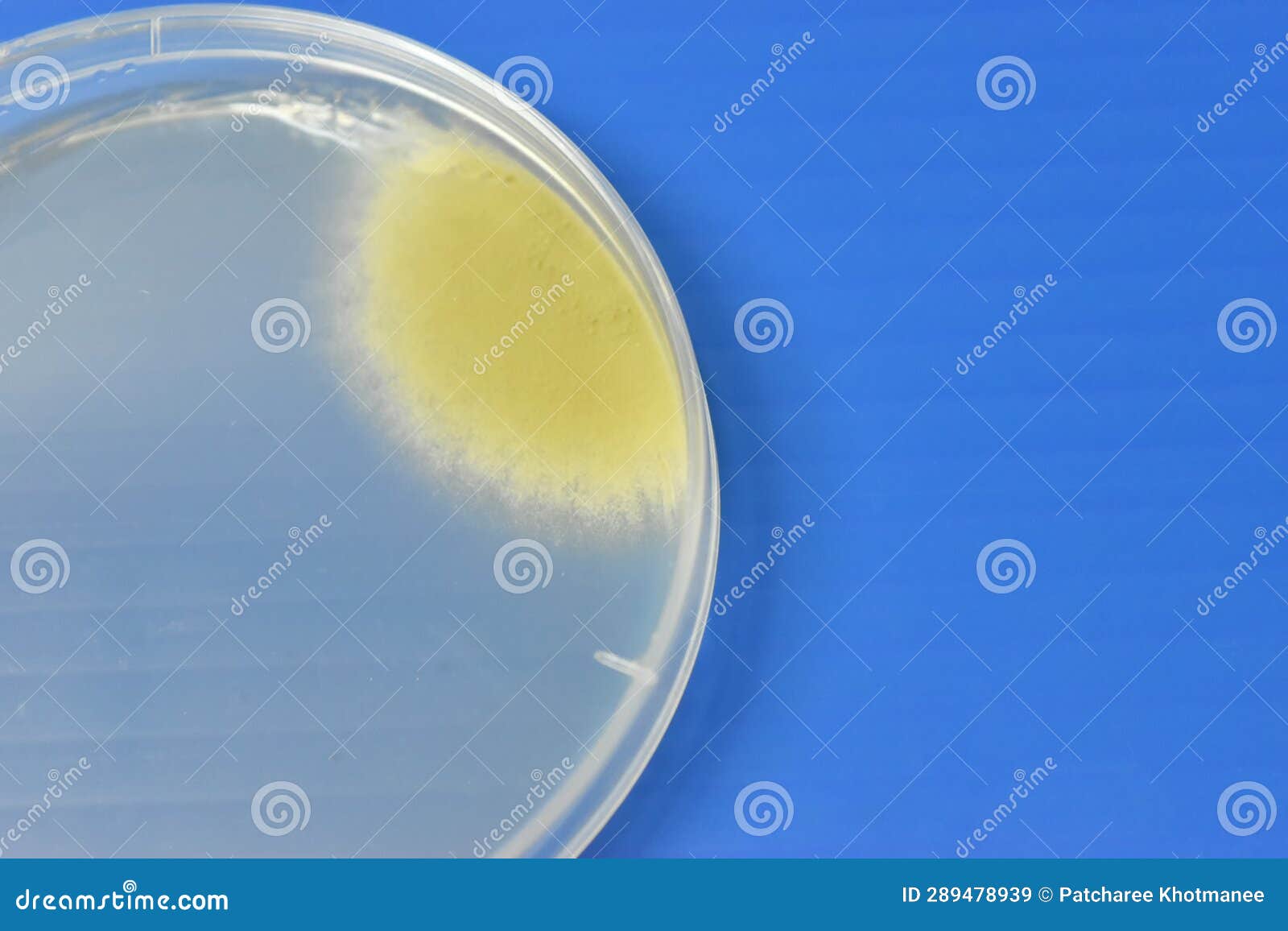 Colonies of Bacteria Growth on Agar Plate Medium in Laboratory Stock ...
