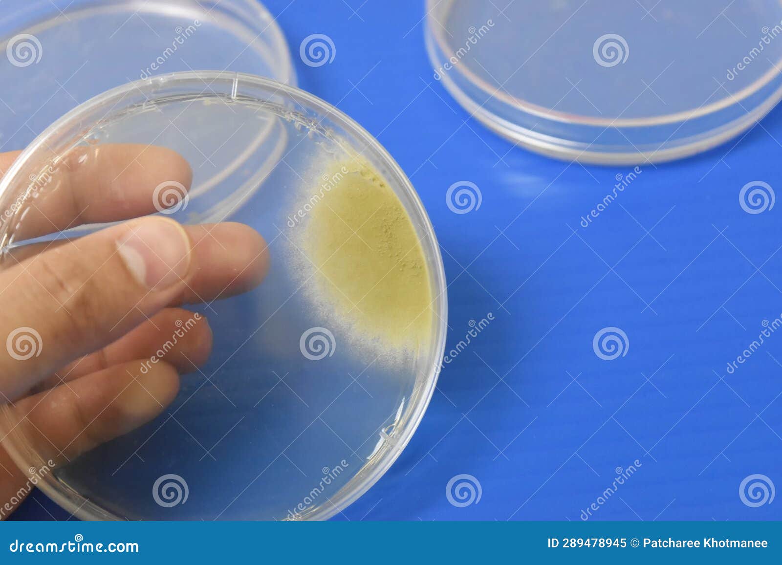 Colonies of Bacteria Growth on Agar Plate Medium in Laboratory Stock ...