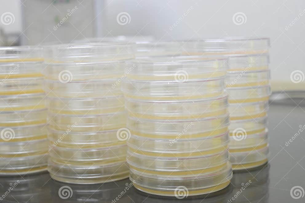 Colonies of Bacteria Growth on Agar Plate Medium in Laboratory Stock ...