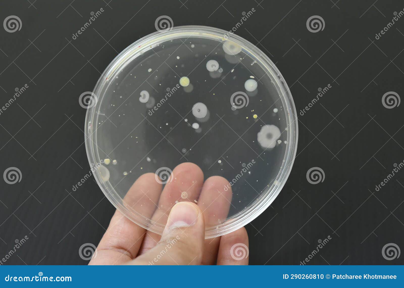 Colonies of Bacteria Growth on Agar Plate Medium in Laboratory Stock ...