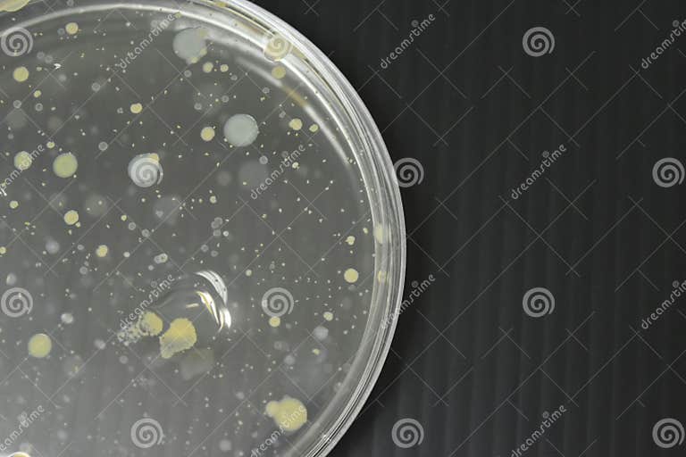 Colonies of Bacteria Growth on Agar Plate Medium in Laboratory Stock ...