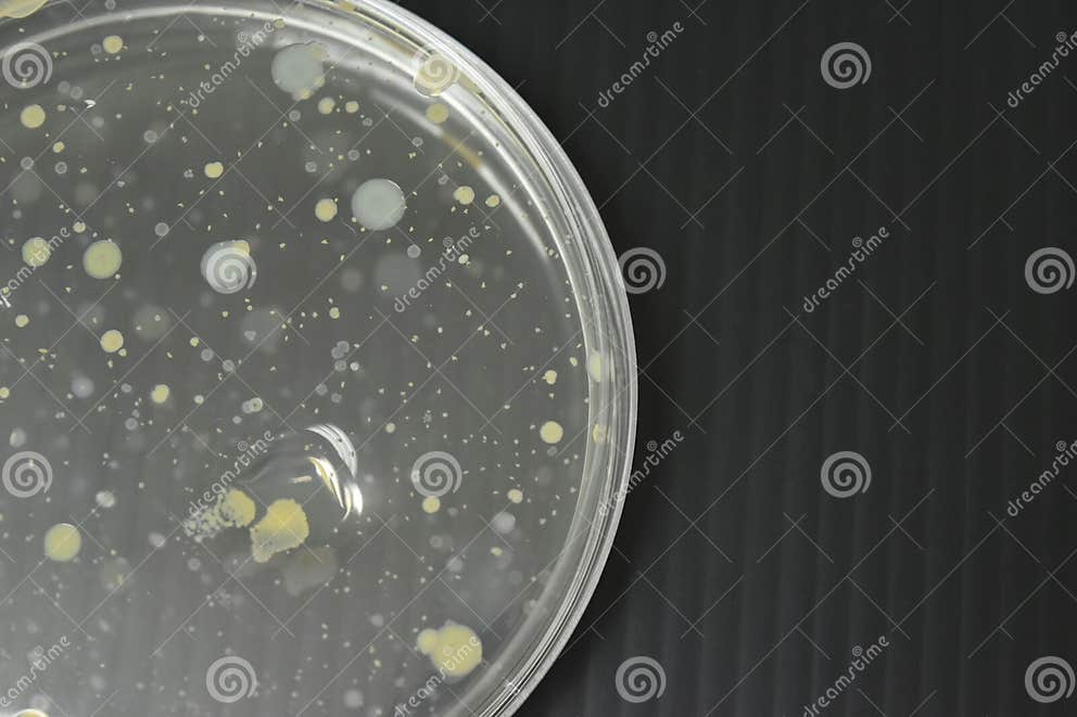 Colonies of Bacteria Growth on Agar Plate Medium in Laboratory Stock ...