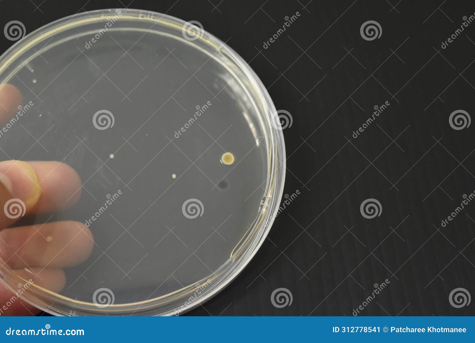 Colonies of Bacteria Growth on Agar Plate Medium in Laboratory Stock ...