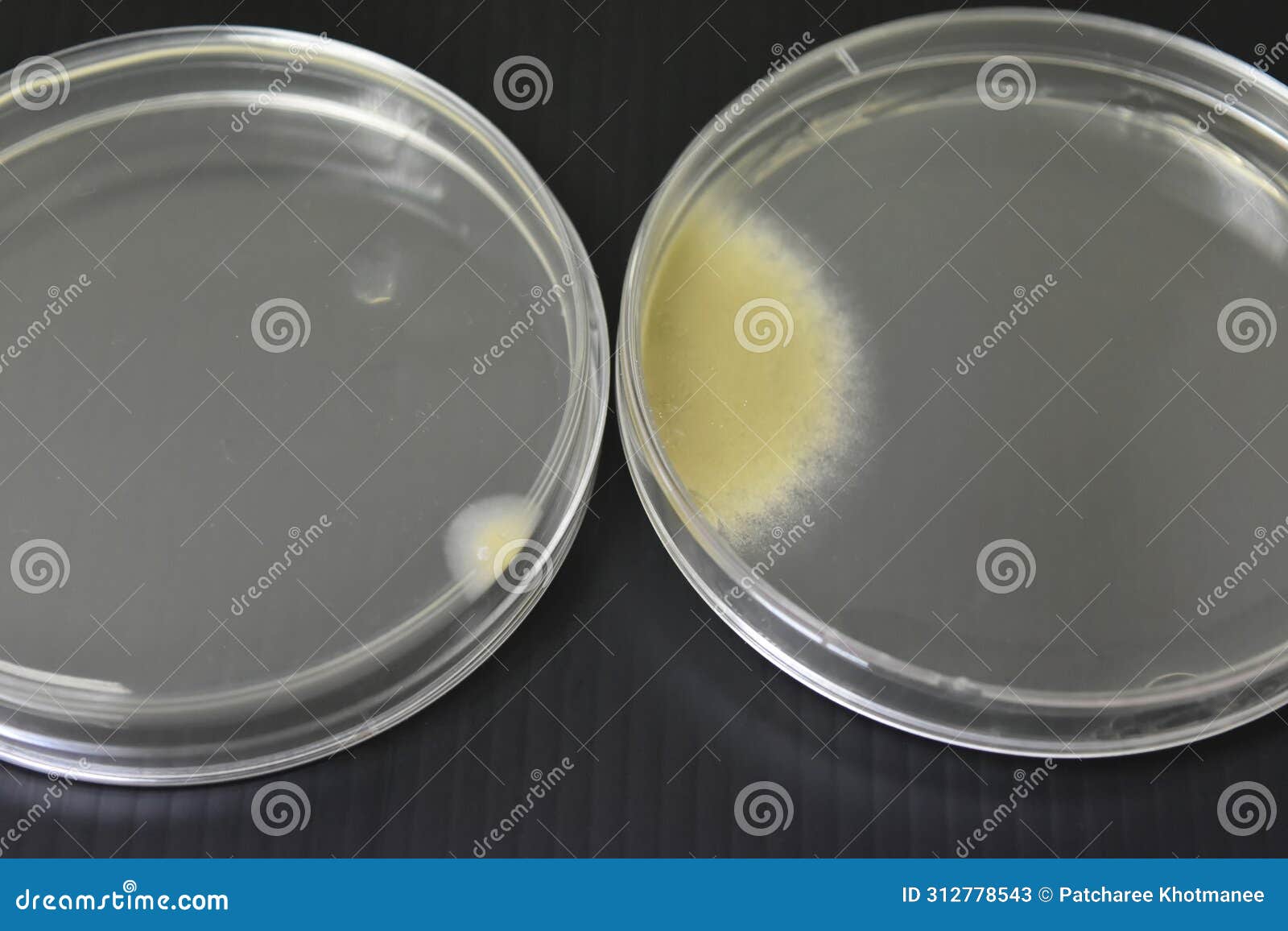 Colonies of Bacteria Growth on Agar Plate Medium in Laboratory Stock ...