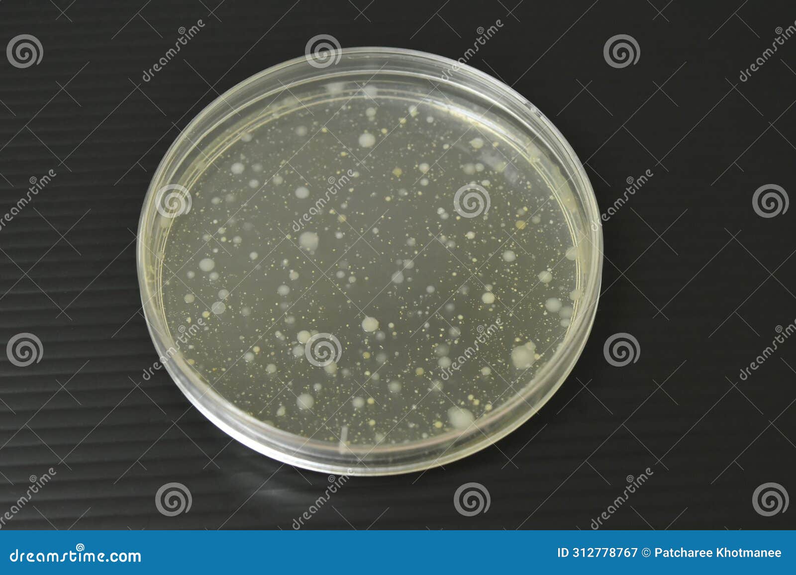 Colonies of Bacteria Growth on Agar Plate Medium in Laboratory Stock ...