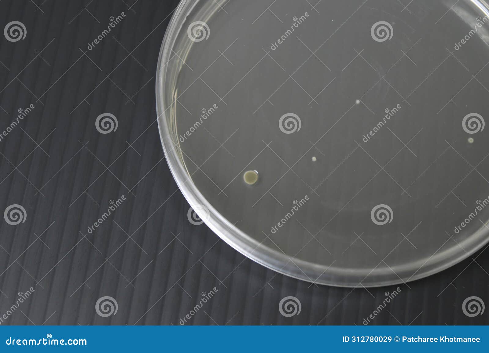 Colonies of Bacteria Growth on Agar Plate Medium in Laboratory Stock ...