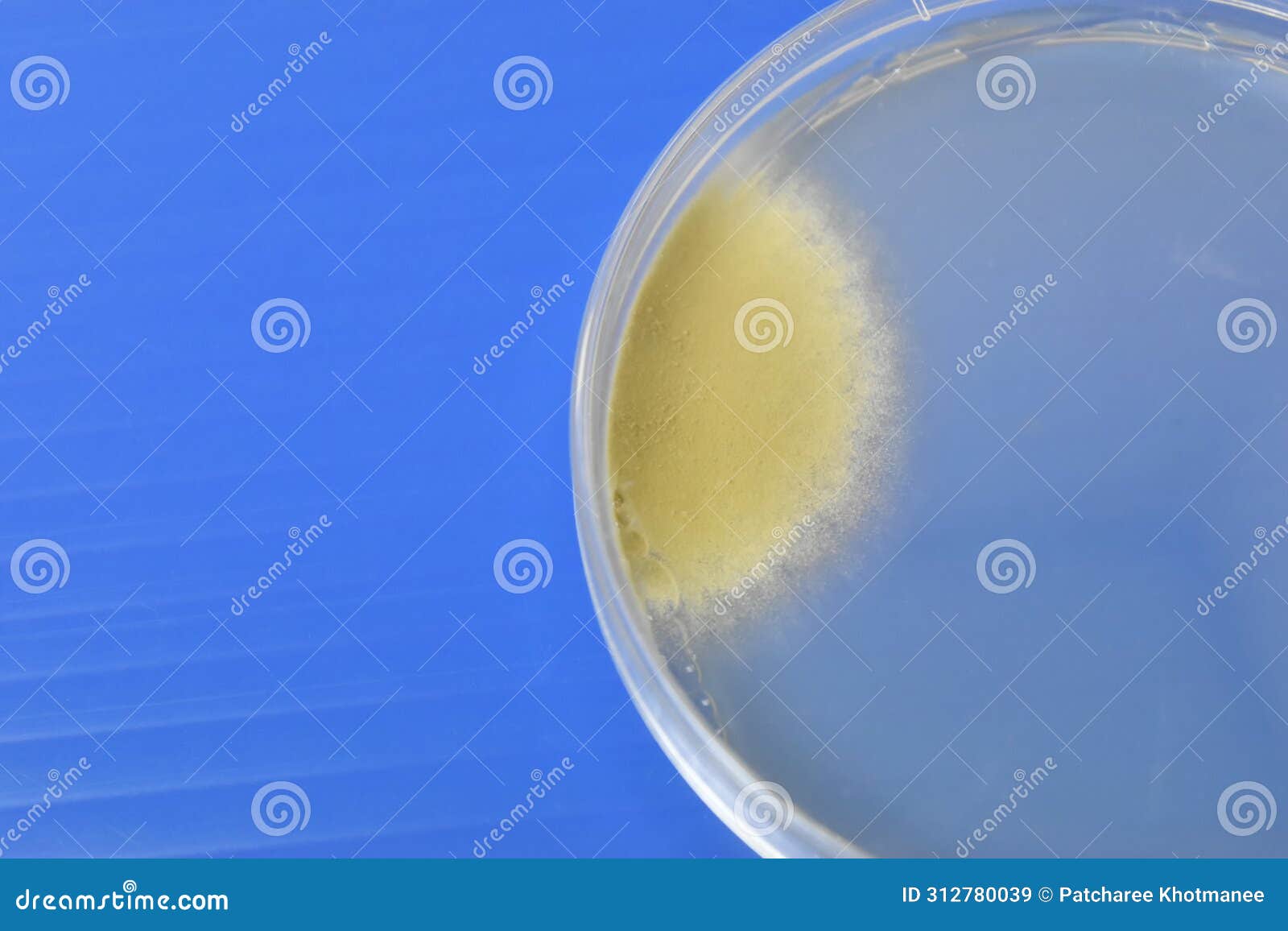 Colonies of Bacteria Growth on Agar Plate Medium in Laboratory Stock ...