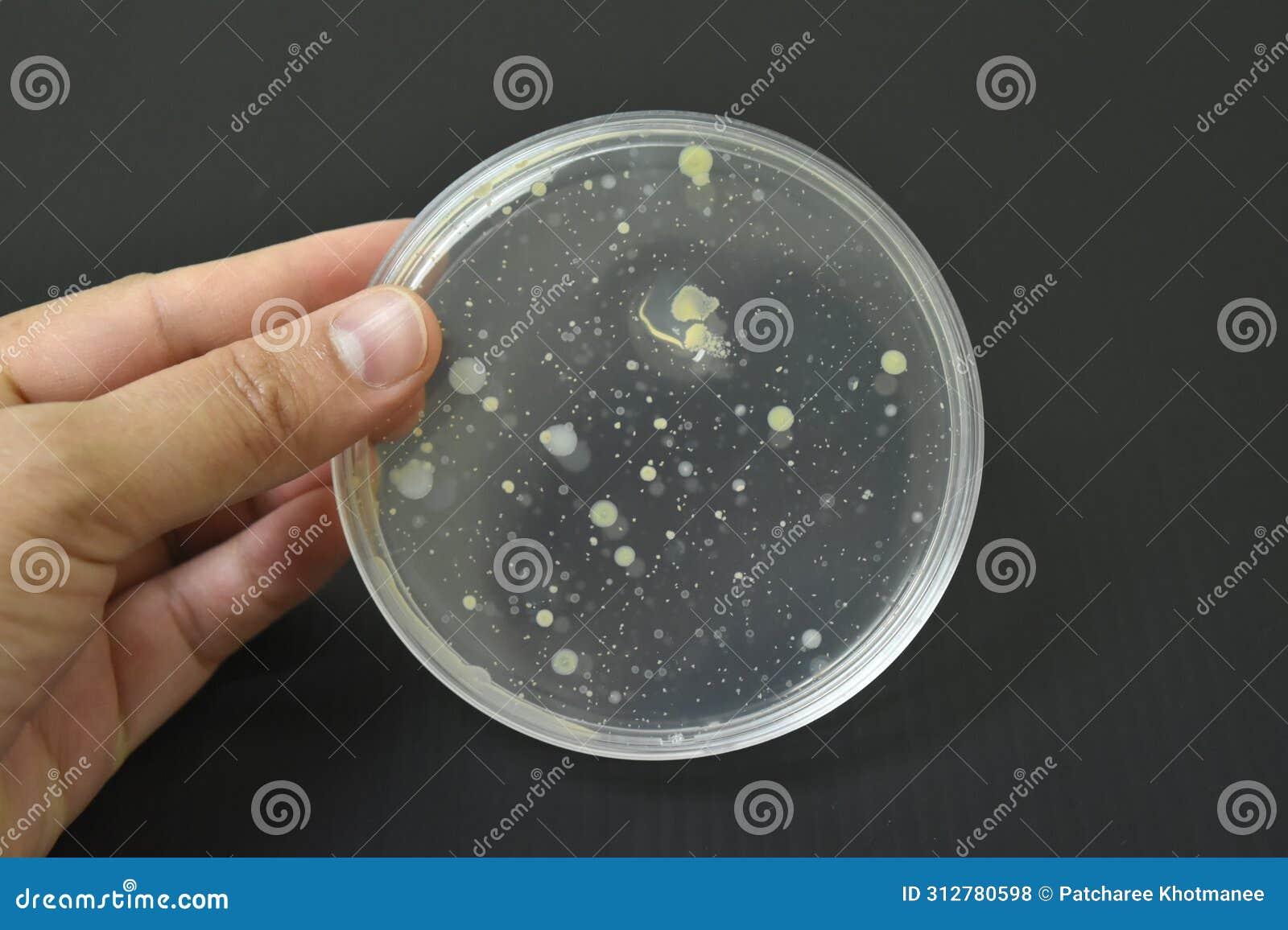 Colonies of Bacteria Growth on Agar Plate Medium in Laboratory Stock ...