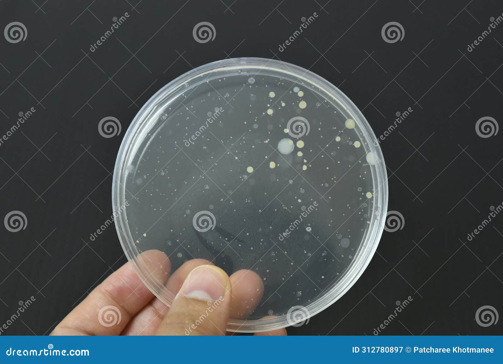 Colonies of Bacteria Growth on Agar Plate Medium in Laboratory Stock ...