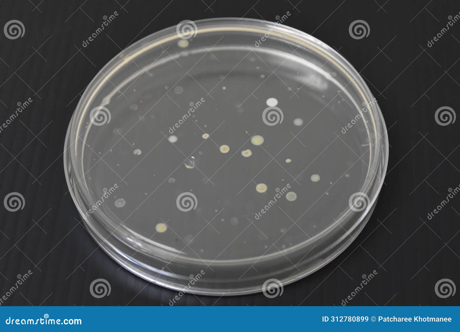Colonies of Bacteria Growth on Agar Plate Medium in Laboratory Stock ...