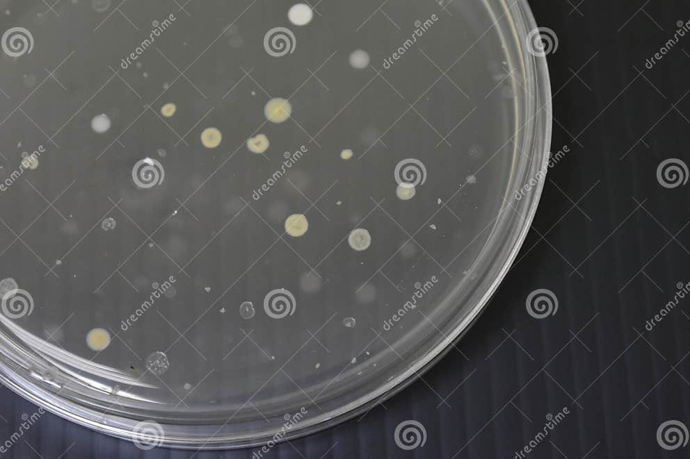 Colonies of Bacteria Growth on Agar Plate Medium in Laboratory Stock ...