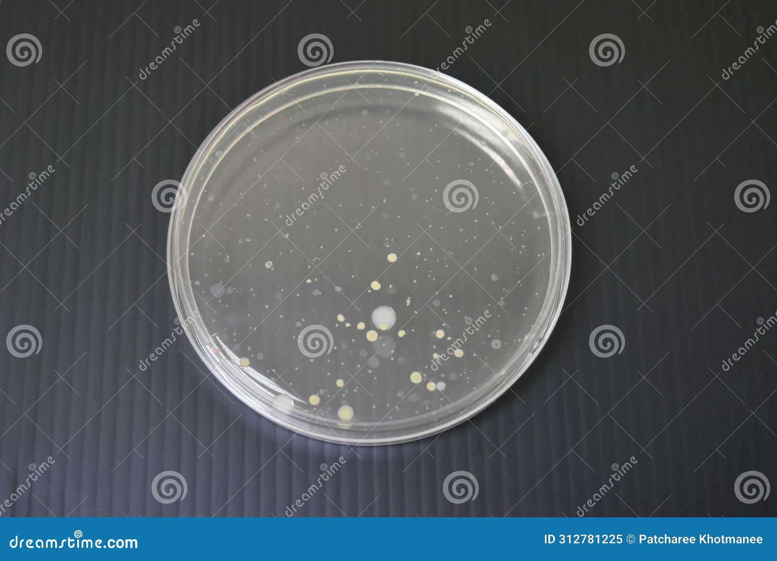 Colonies of Bacteria Growth on Agar Plate Medium in Laboratory Stock ...