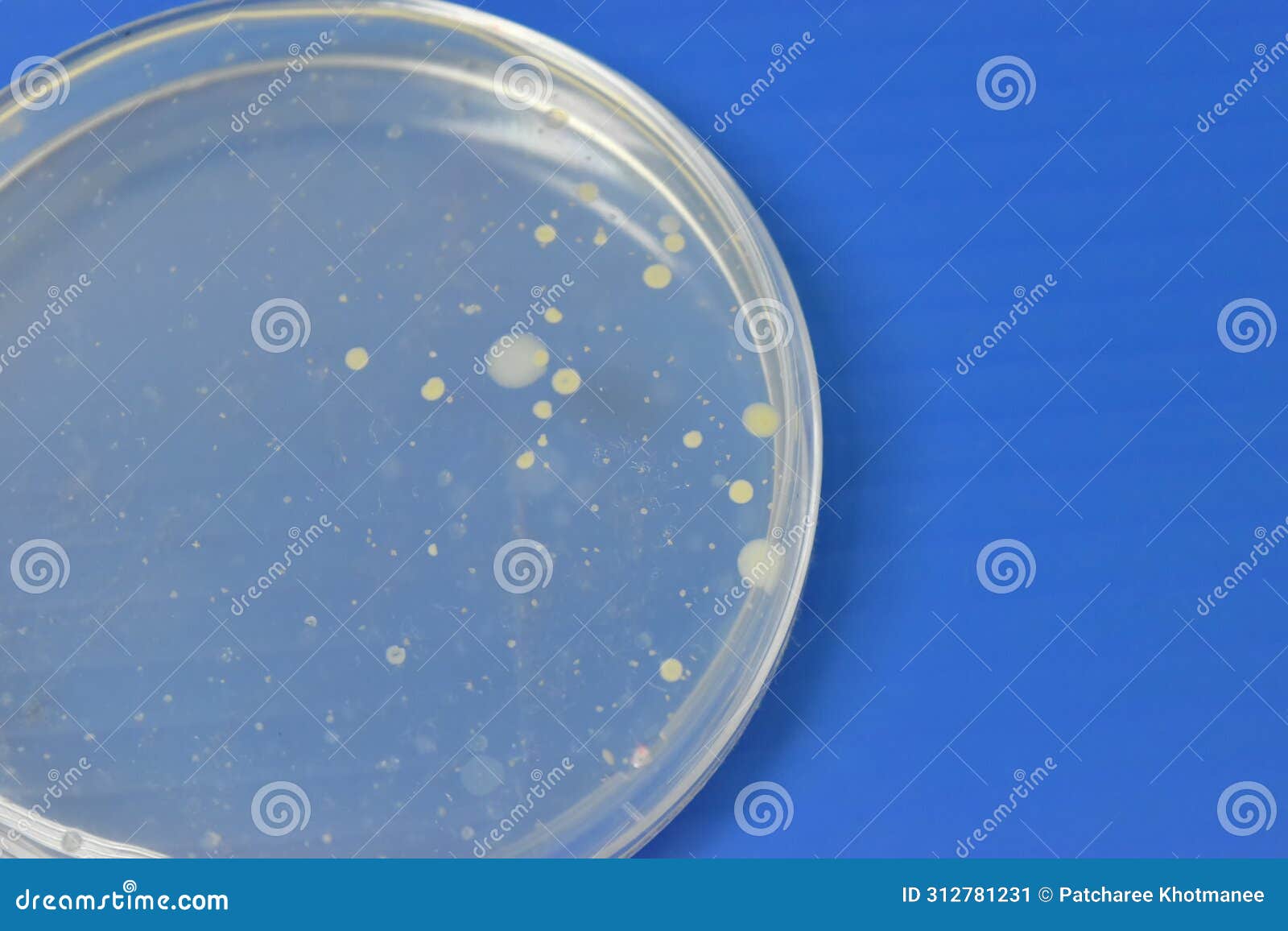 Colonies of Bacteria Growth on Agar Plate Medium in Laboratory Stock ...