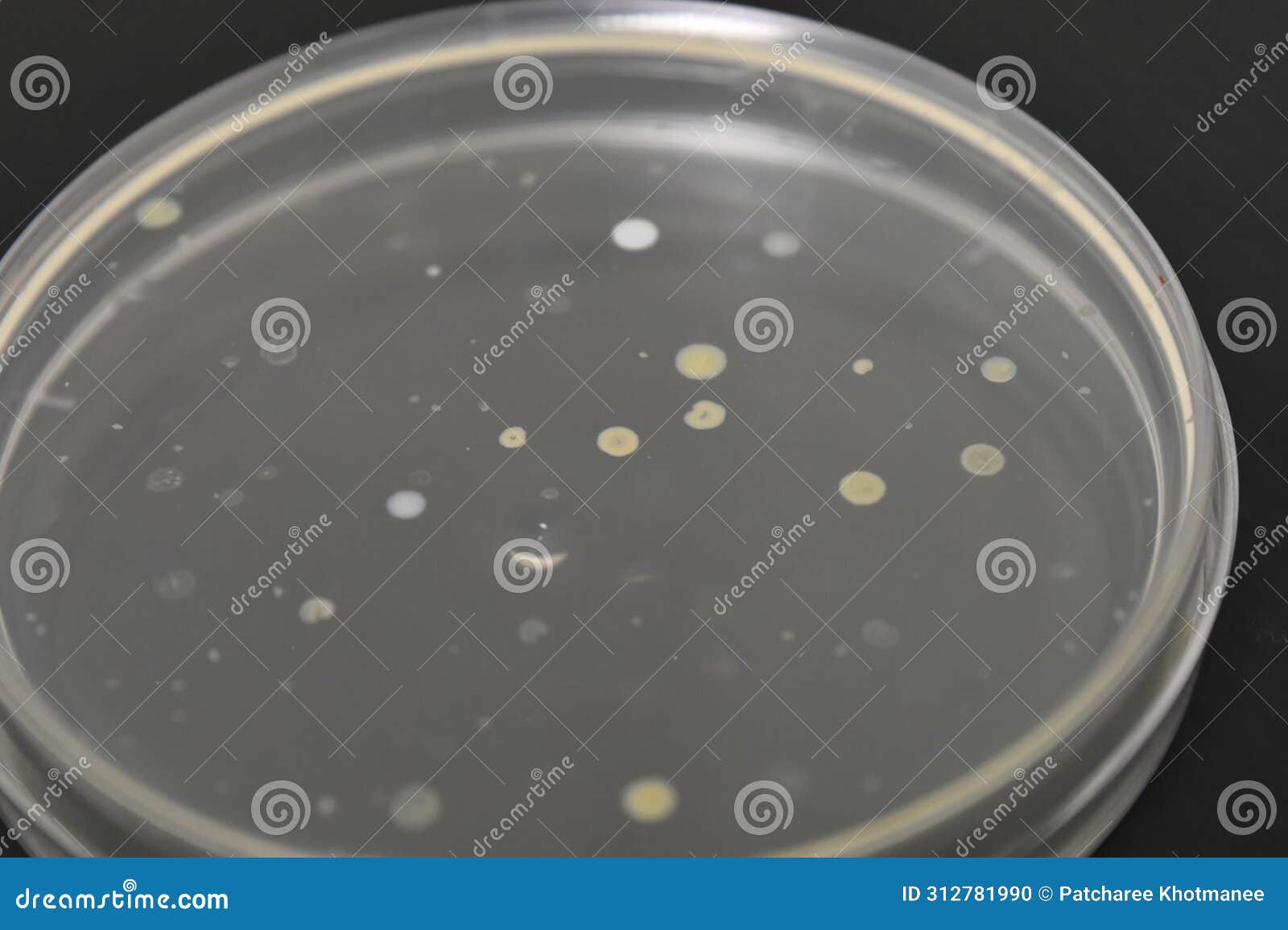 Colonies Of Bacteria Growth On Agar Plate Medium In Laboratory Royalty ...