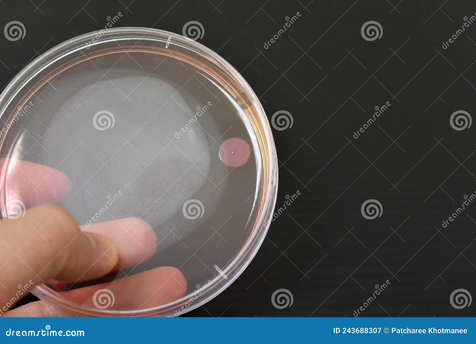 Colonies of Bacteria Growth on Agar Plate Medium Stock Image - Image of ...