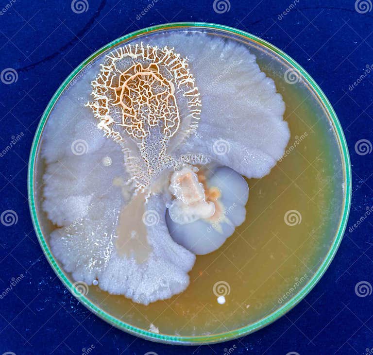 Colonies of Bacteria and Microorganisms on the Surface of Agar and Wind ...