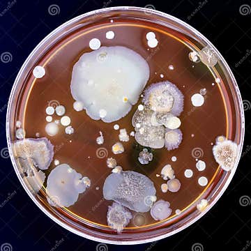 Colonies of Bacteria and Microorganisms on the Surface of Agar and Wind ...