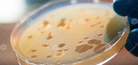 Colonies of Bacteria and Microorganisms on the Surface of Agar and Wind ...