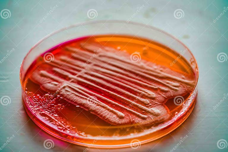 Colonies of Bacteria and Microorganisms on the Surface of Agar and Wind ...