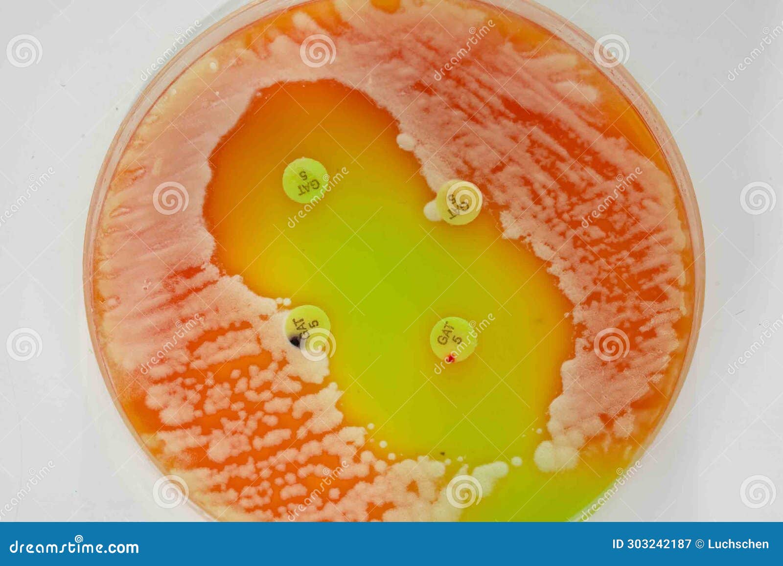 Colonies of Bacteria and Microorganisms on the Surface of Agar and Wind ...