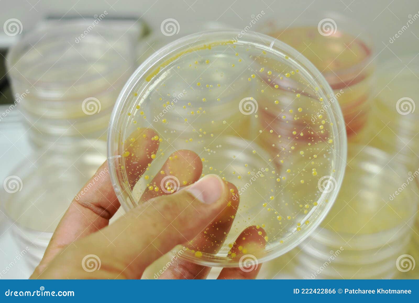 Colonies Of Bacteria Micrococcus Luteus On Tryptic Soy Agar Stock Photo ...