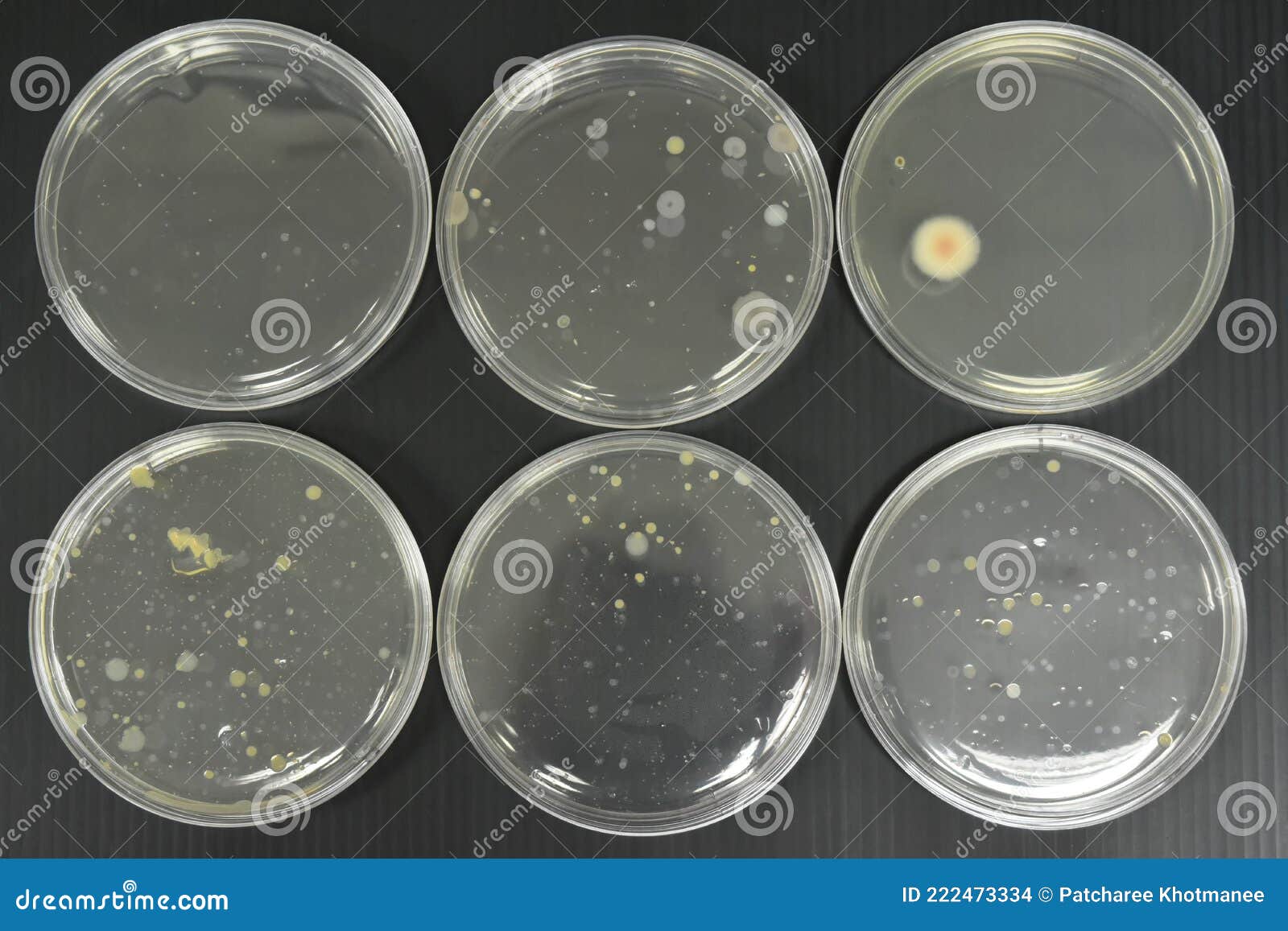 Colonies of Bacteria in Petri Dish Stock Photo - Image of food ...
