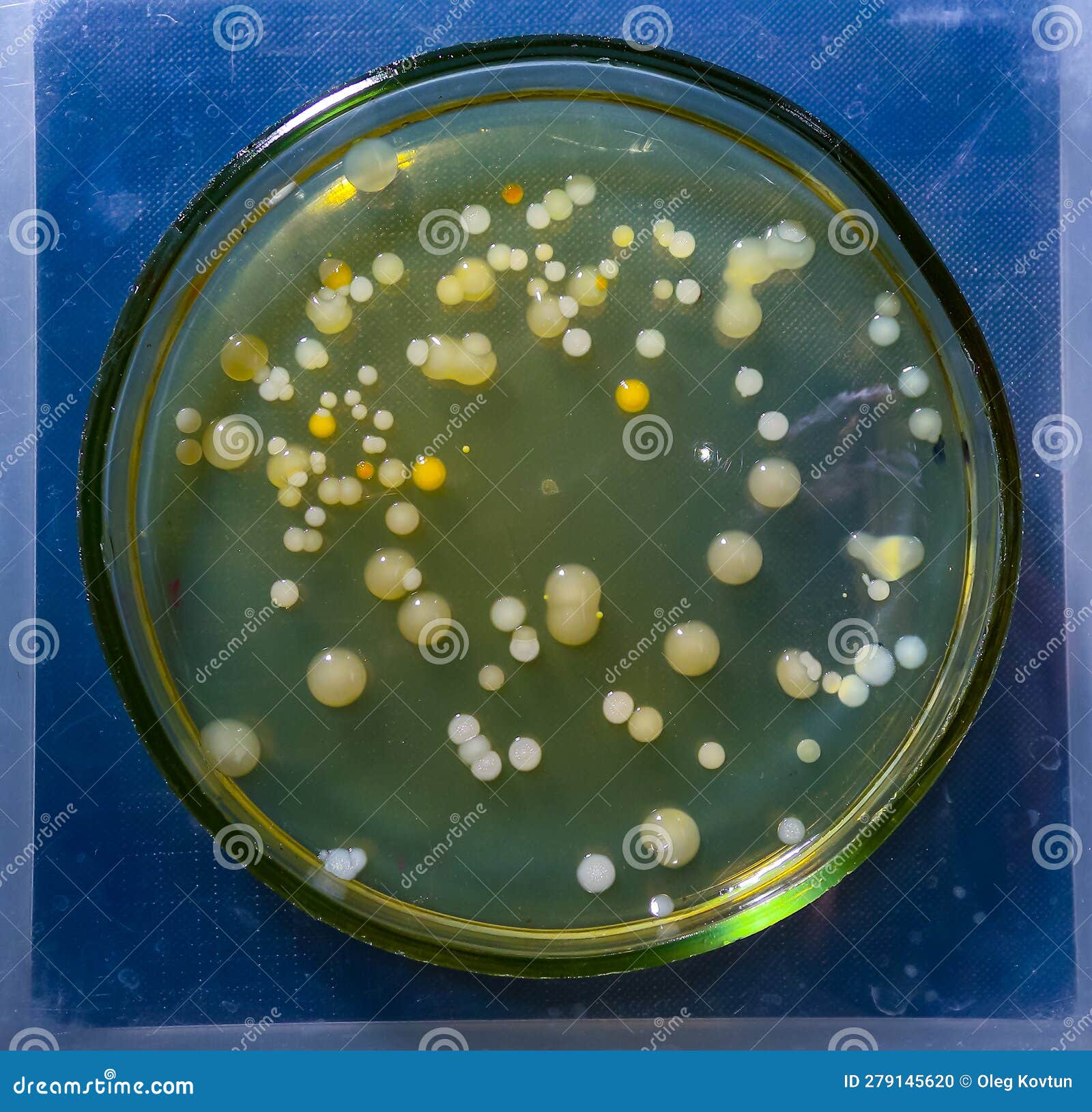 Colonies of Pathogenic Bacteria in a Petri Dish, Microbiological ...