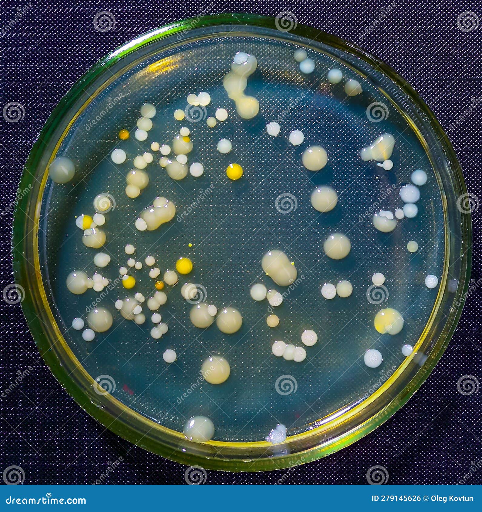 Colonies of Pathogenic Bacteria in a Petri Dish, Microbiological ...