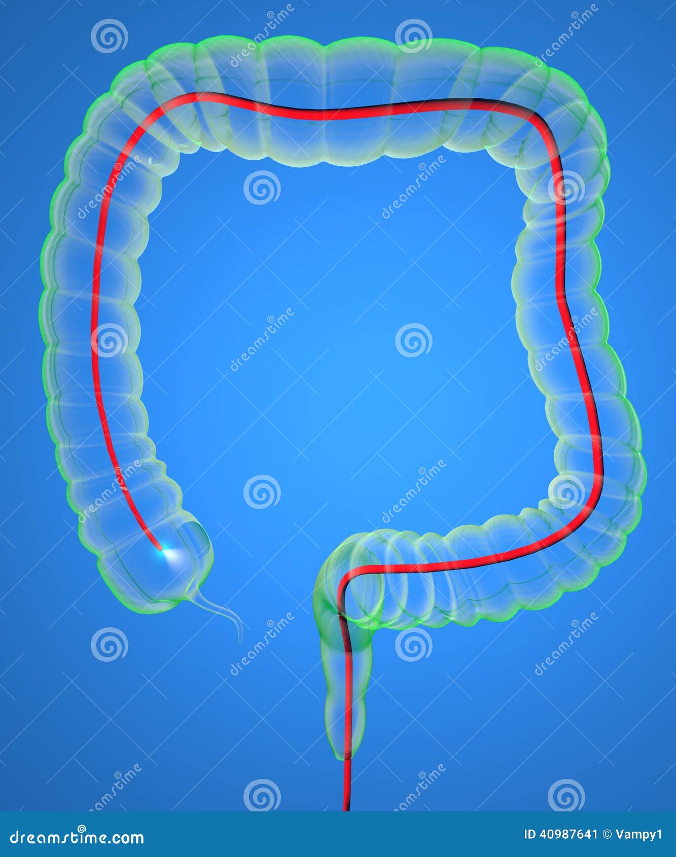 Colonoscopy and probe stock illustration. Illustration of digestive ...