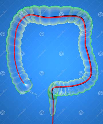 Colonoscopy and probe stock illustration. Illustration of digestive ...