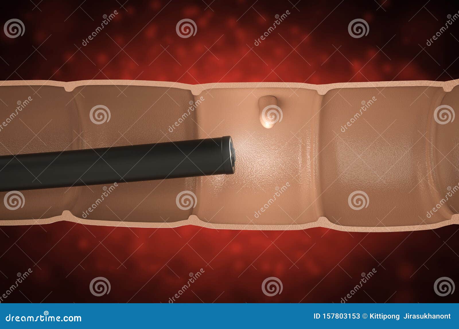 Colonoscopy. Inside Of Healthy Colon, Large Intestine.Human Digestive ...