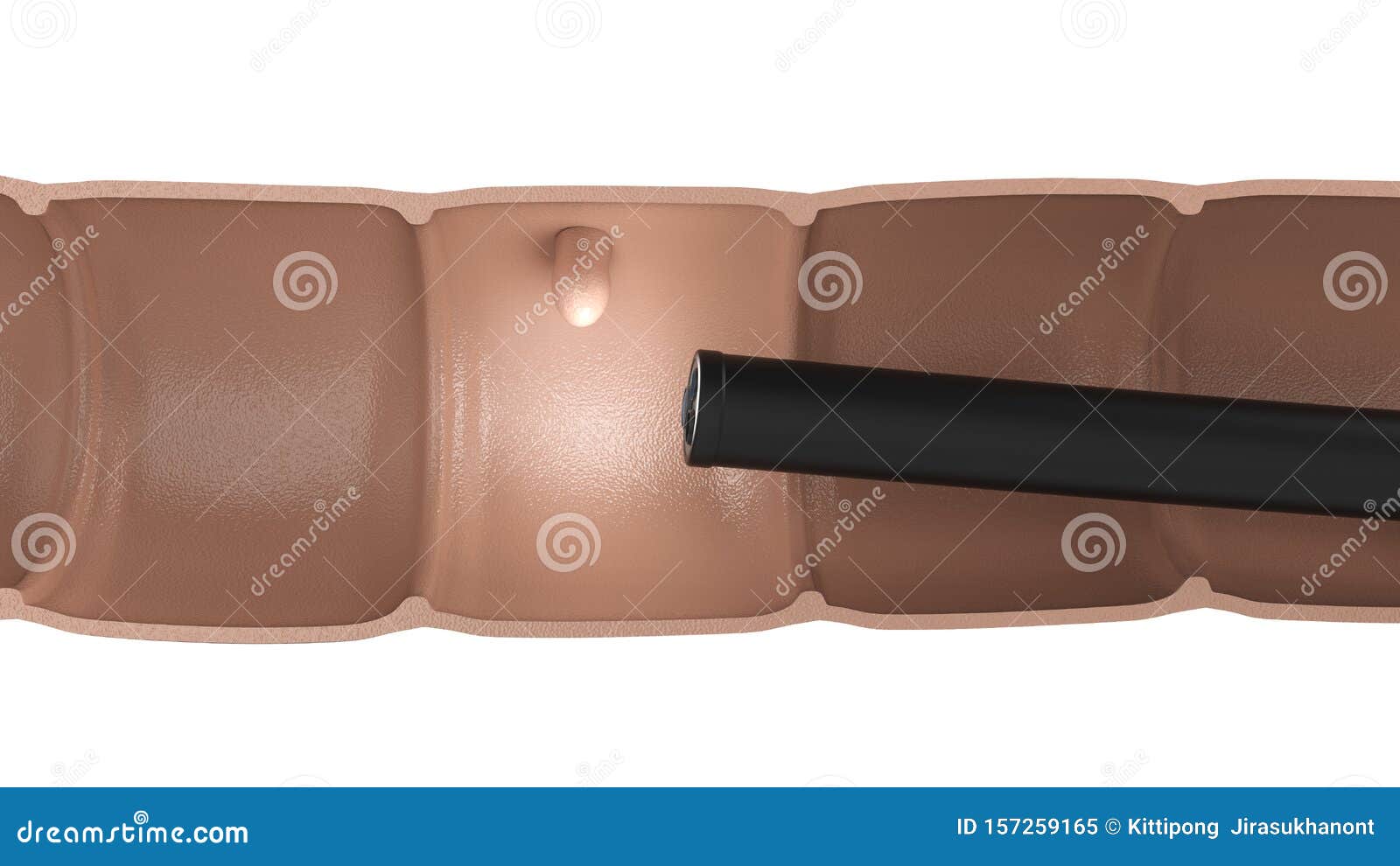 Colonoscopy. Inside Of Healthy Colon, Large Intestine.Human Digestive ...