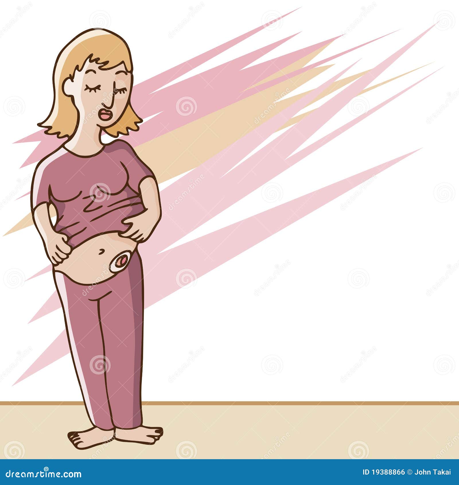 Woman With Stoma And Colostomy Bag Vector Illustration | CartoonDealer ...