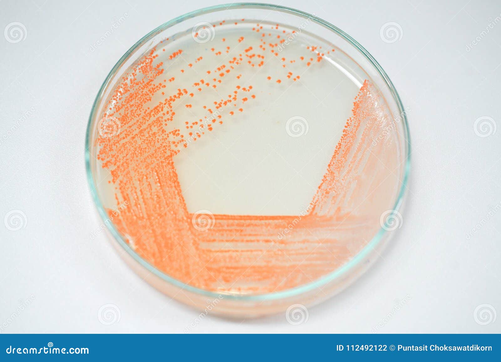 Colony of Bacteria in Culture Medium Plate. Stock Photo - Image of ...