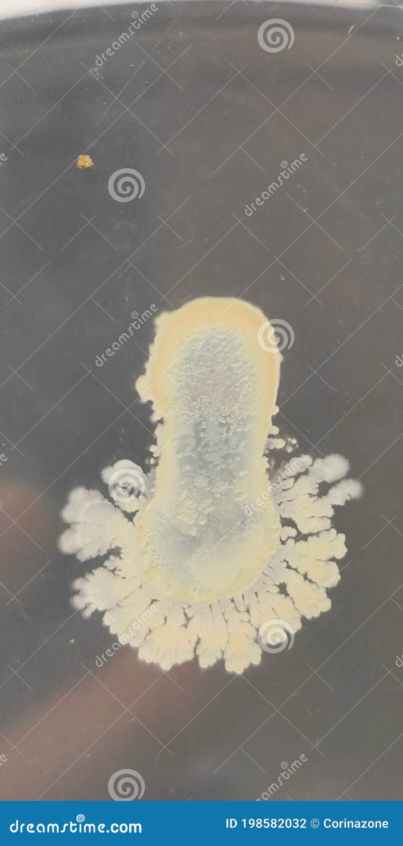 Bacterial Colony on Nutrient Agar Medium Stock Photo - Image of ...