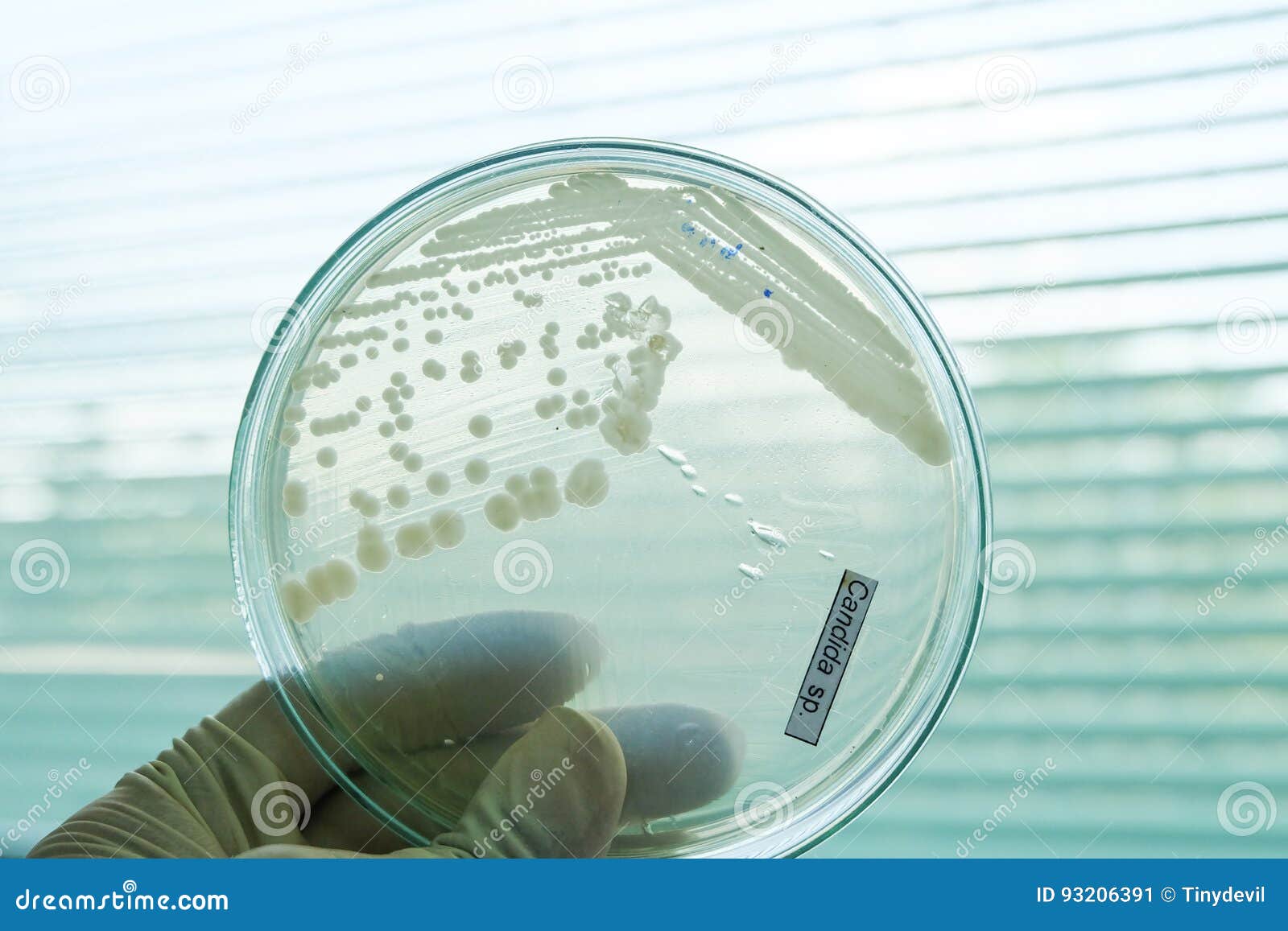 Colony of bacteria stock image. Image of agar, laboratory - 93206391