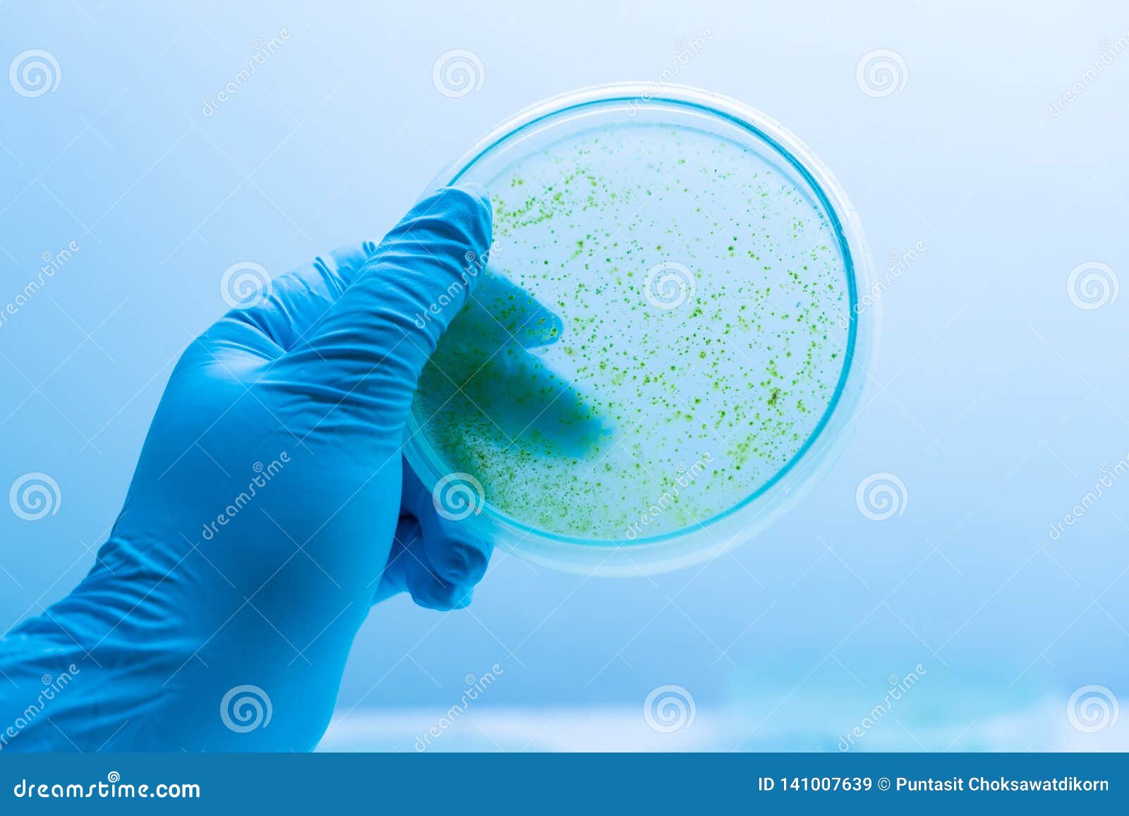 Colony of Blue Green Algae in Culture Medium Plate Stock Image - Image ...