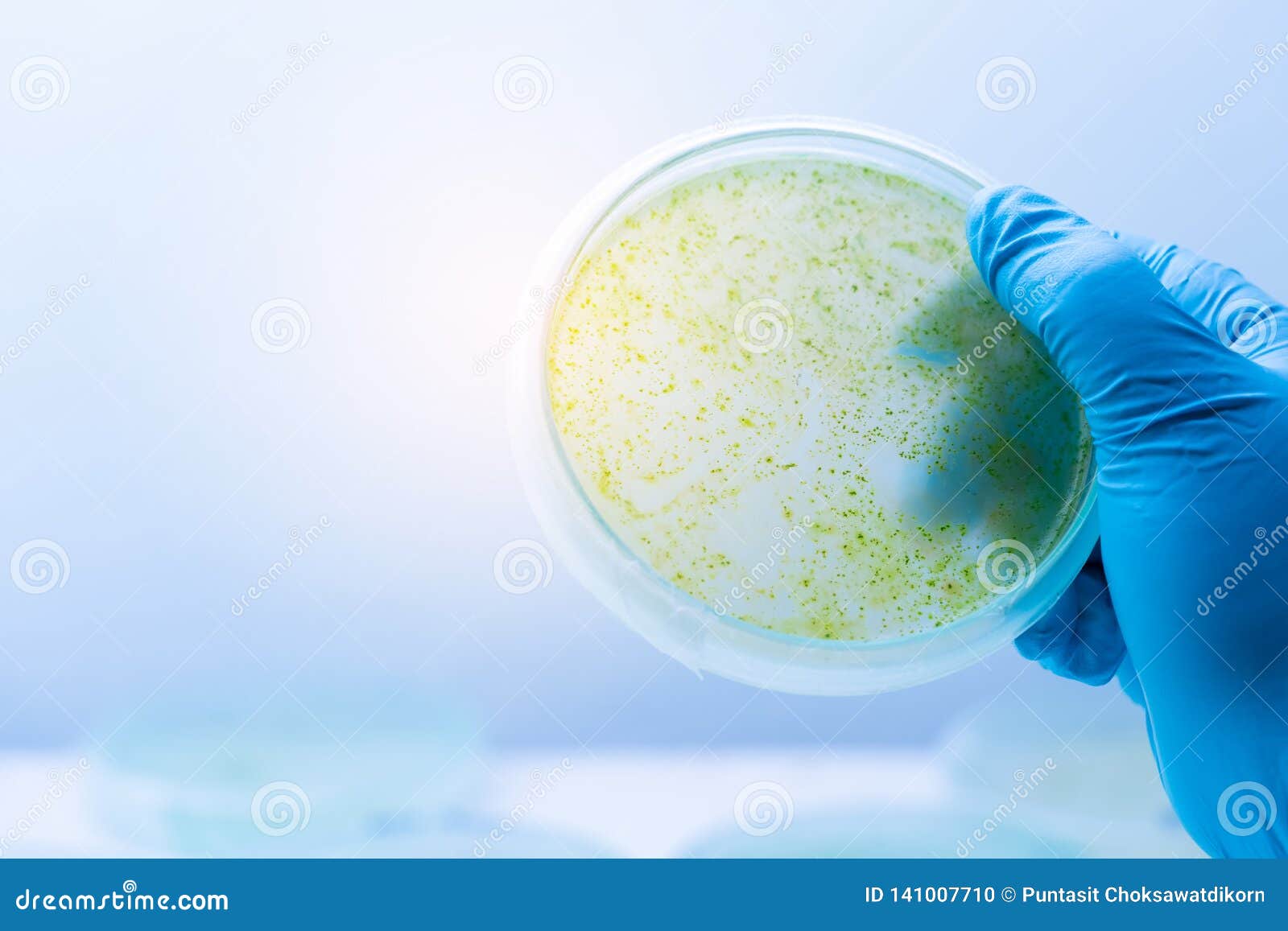 Colony of Blue Green Algae in Culture Medium Plate Stock Photo - Image ...